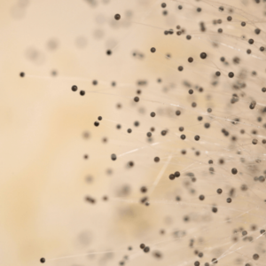 What Do Mold Spores Look Like? Signs You Might Be Missing | Howard ...